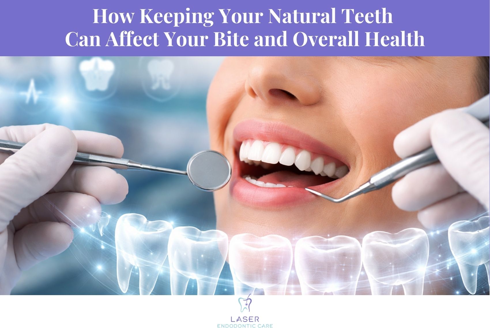 How Keeping Your Natural Teeth Can Affect Your Bite and Overall Health ...